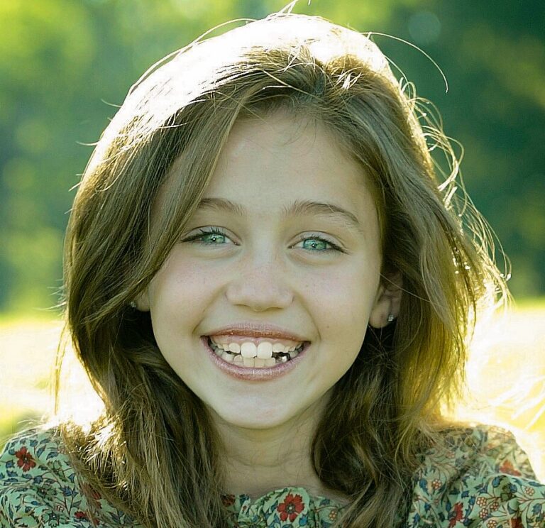 Miley Cyrus Teeth | A Transformation Story - Parla Clinics