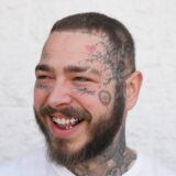 Post Malone Teeth: The Interesting Story Behind His Iconic Smile ...