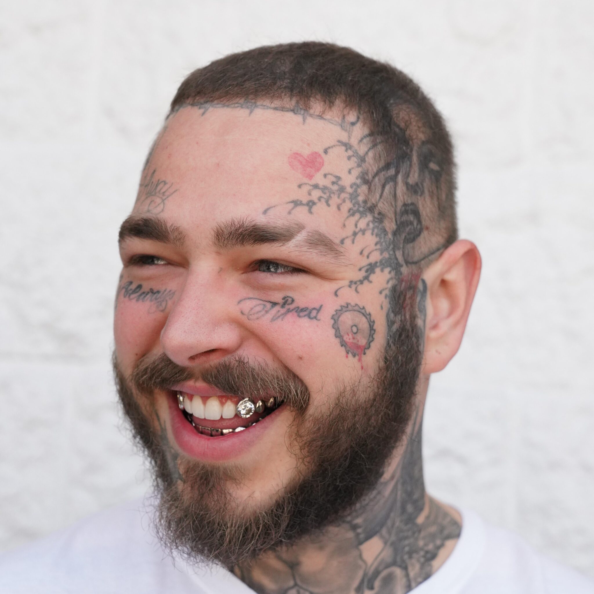 Post Malone Teeth: The Interesting Story Behind His Iconic Smile ...