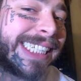 Post Malone Teeth: The Interesting Story Behind His Iconic Smile ...